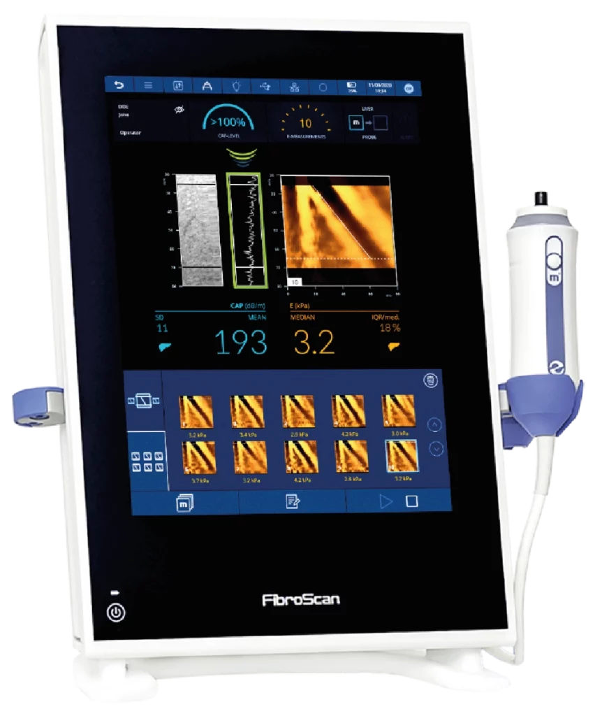 Fibroscan - Promed