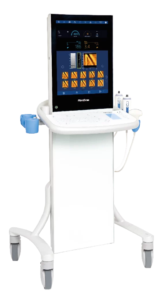 Fibroscan - Promed