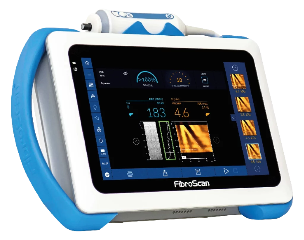 Fibroscan - Promed