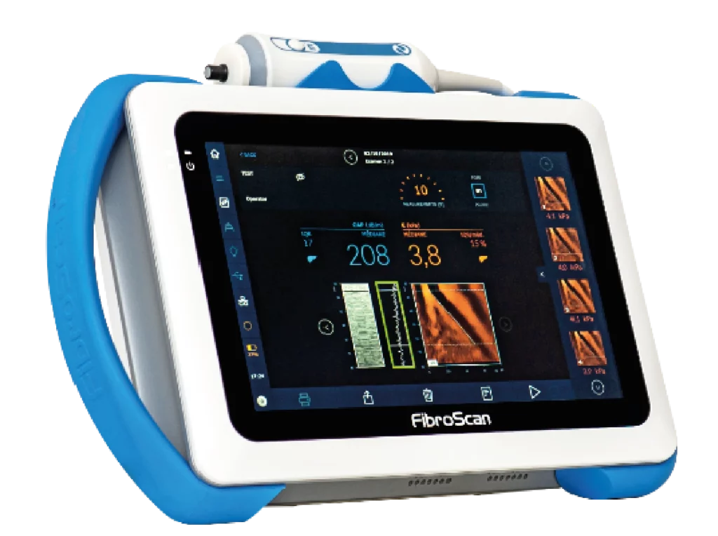 Fibroscan - Promed